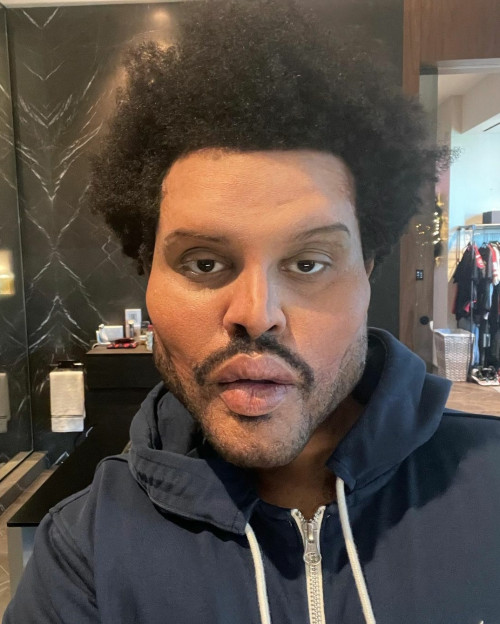 TheWeeknd new face hensem or not?