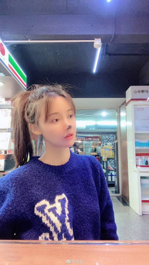 Chinese actress Gao Liu cosmetic surgery failure