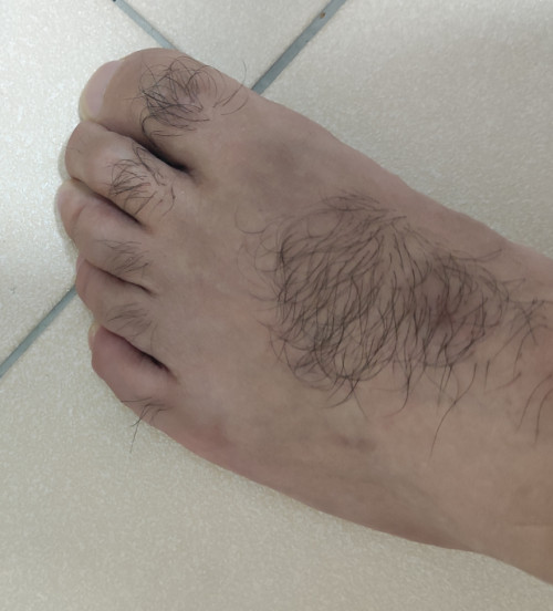 Longest toe's hair