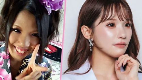 Japan Amoi transforms look through surgery..