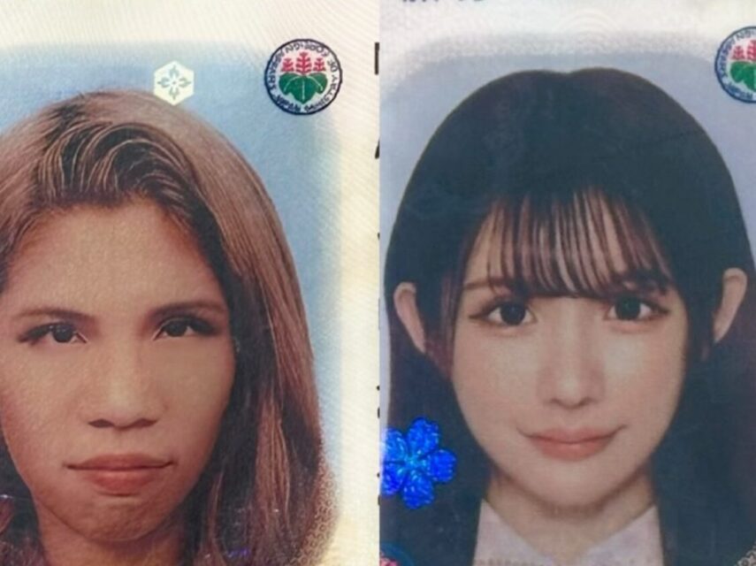 Japan Amoi transforms look through surgery..
